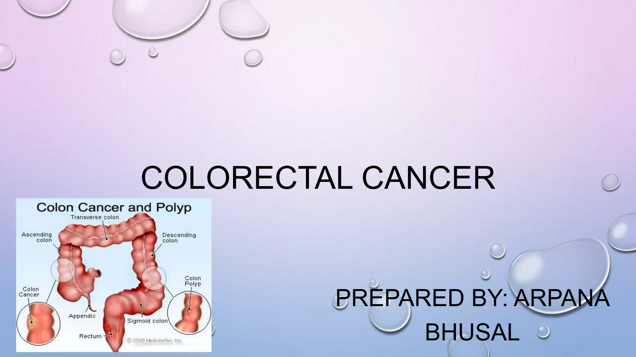 Colorectal Cancer | PPTX