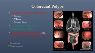 Colorectal Cancer | PDF