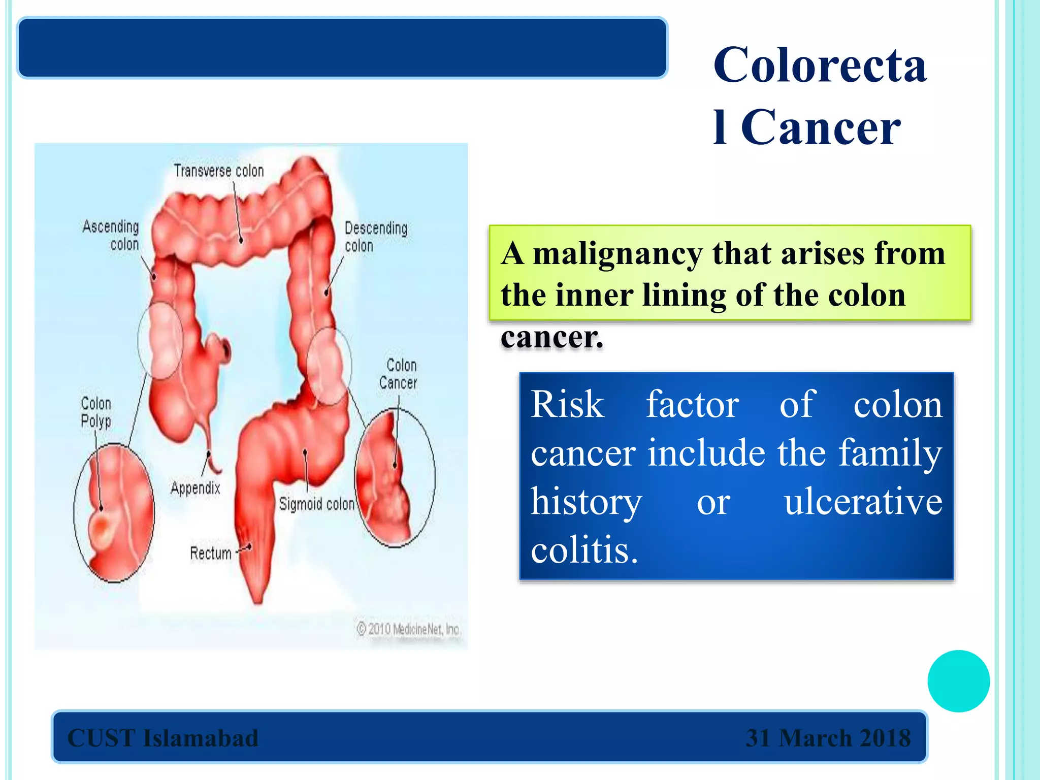 Colorectal cancer and immunity inflammation | PPT