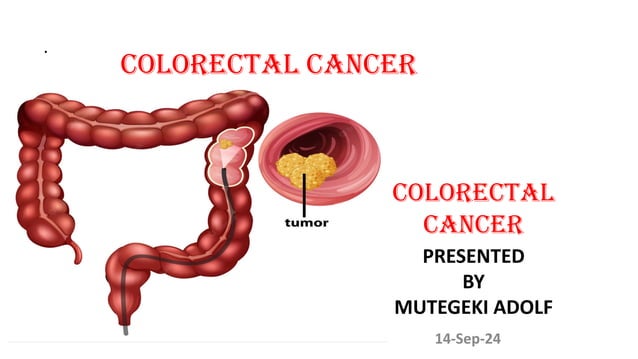 Colorectal cancer (CRC), cancer of the rectum and colon | PDF ...