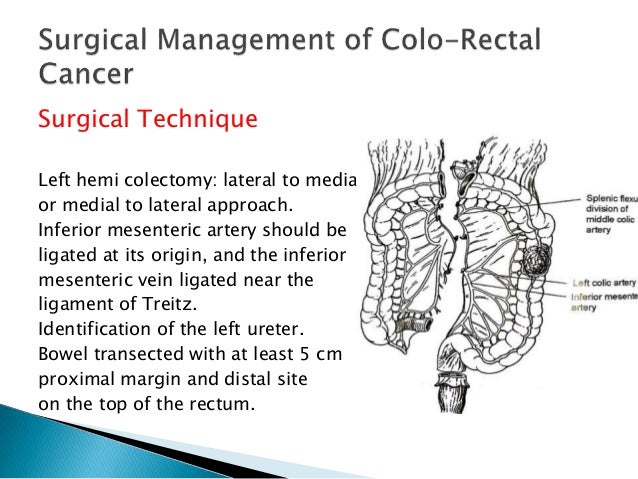 Colo rectal cancer management