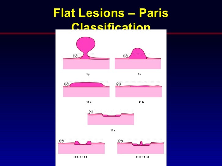 Colorectal cancer screening