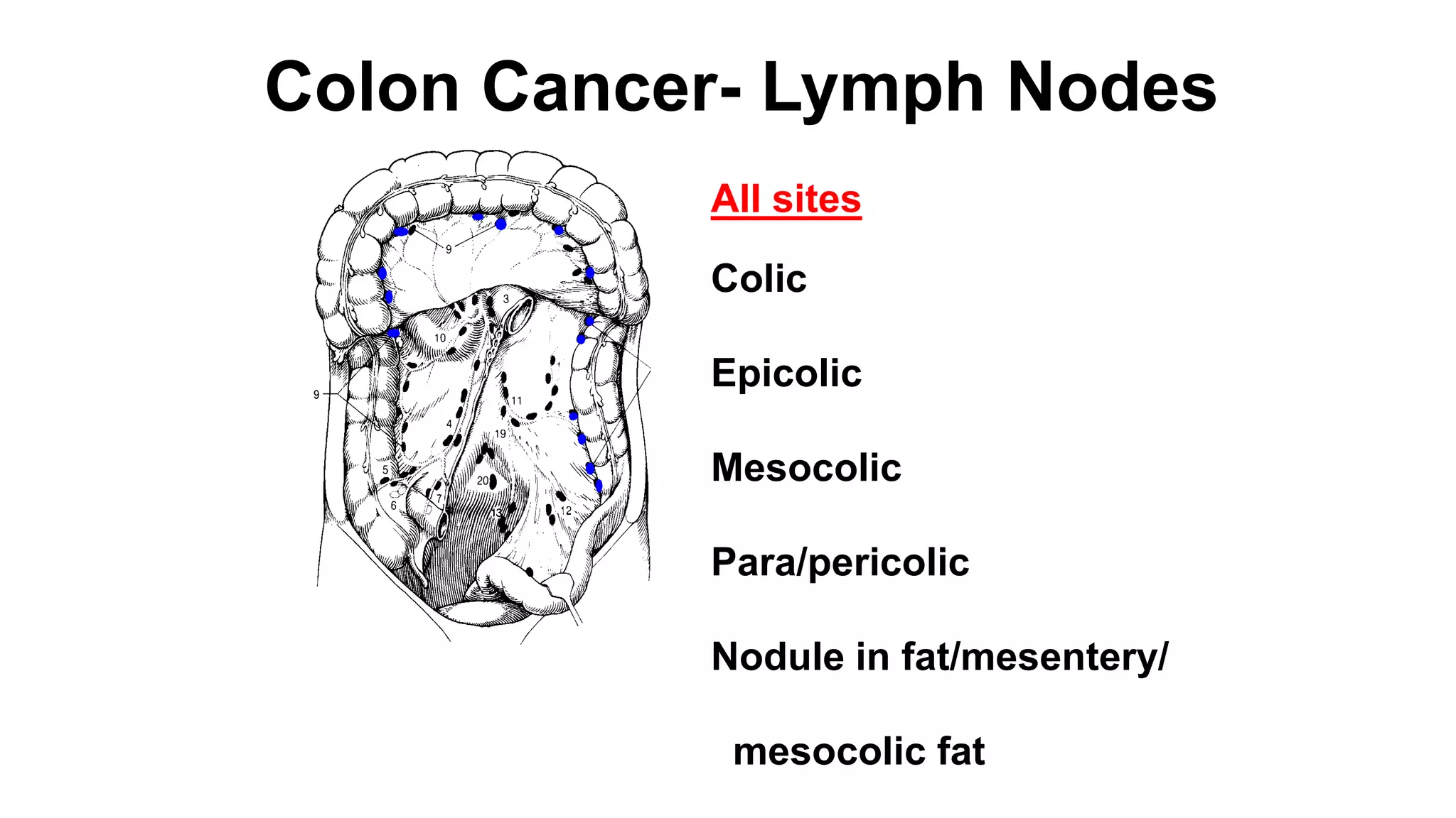 Colorectal carcinoma anatomy to management | PPTX