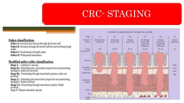 Colorectal carcinoma - lower gi hemorrhage