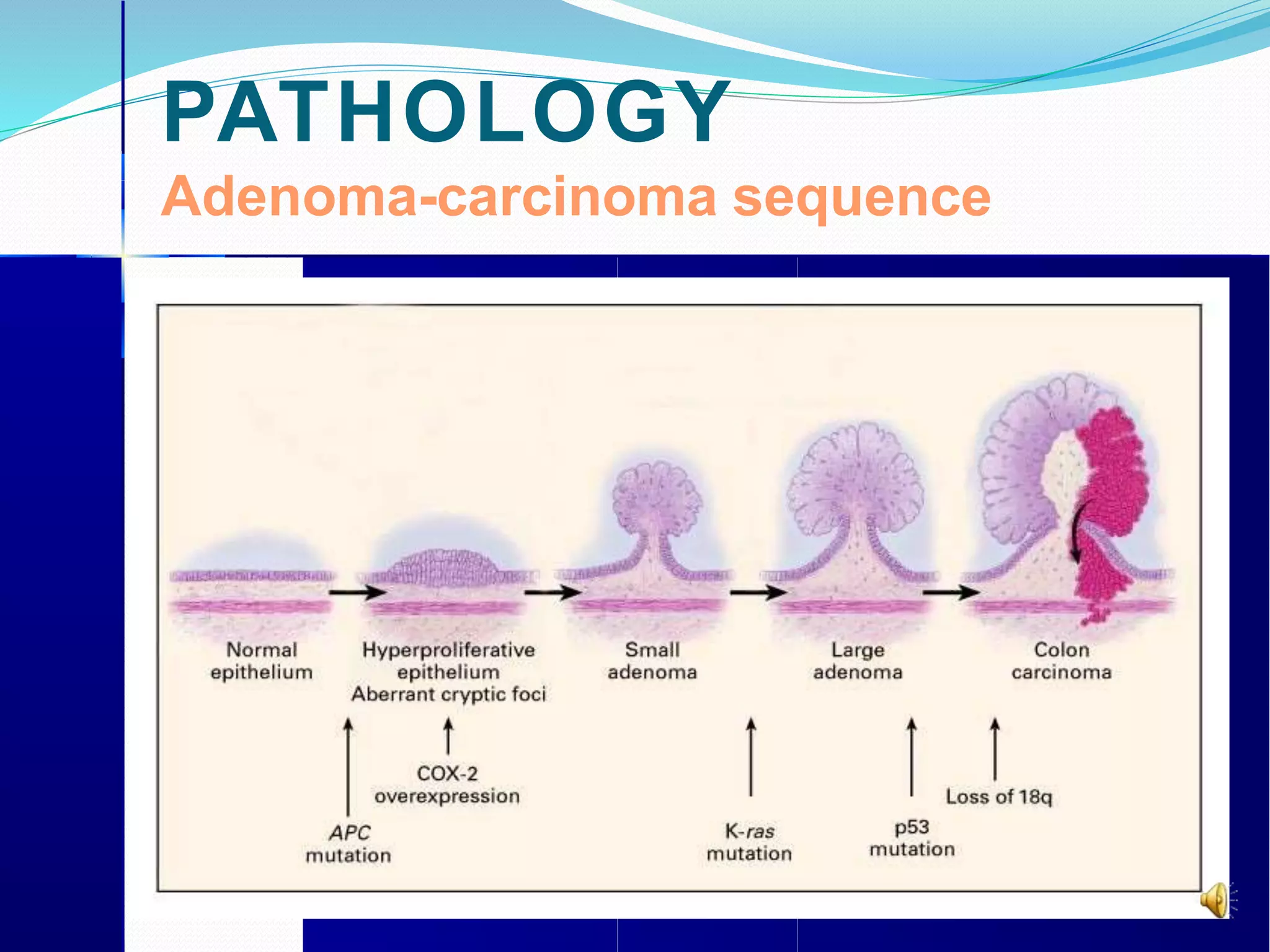 Colorectal carcinoma gist carcinoid tumour | PPTX