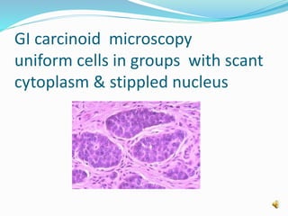 Colorectal carcinoma gist carcinoid tumour | PPTX