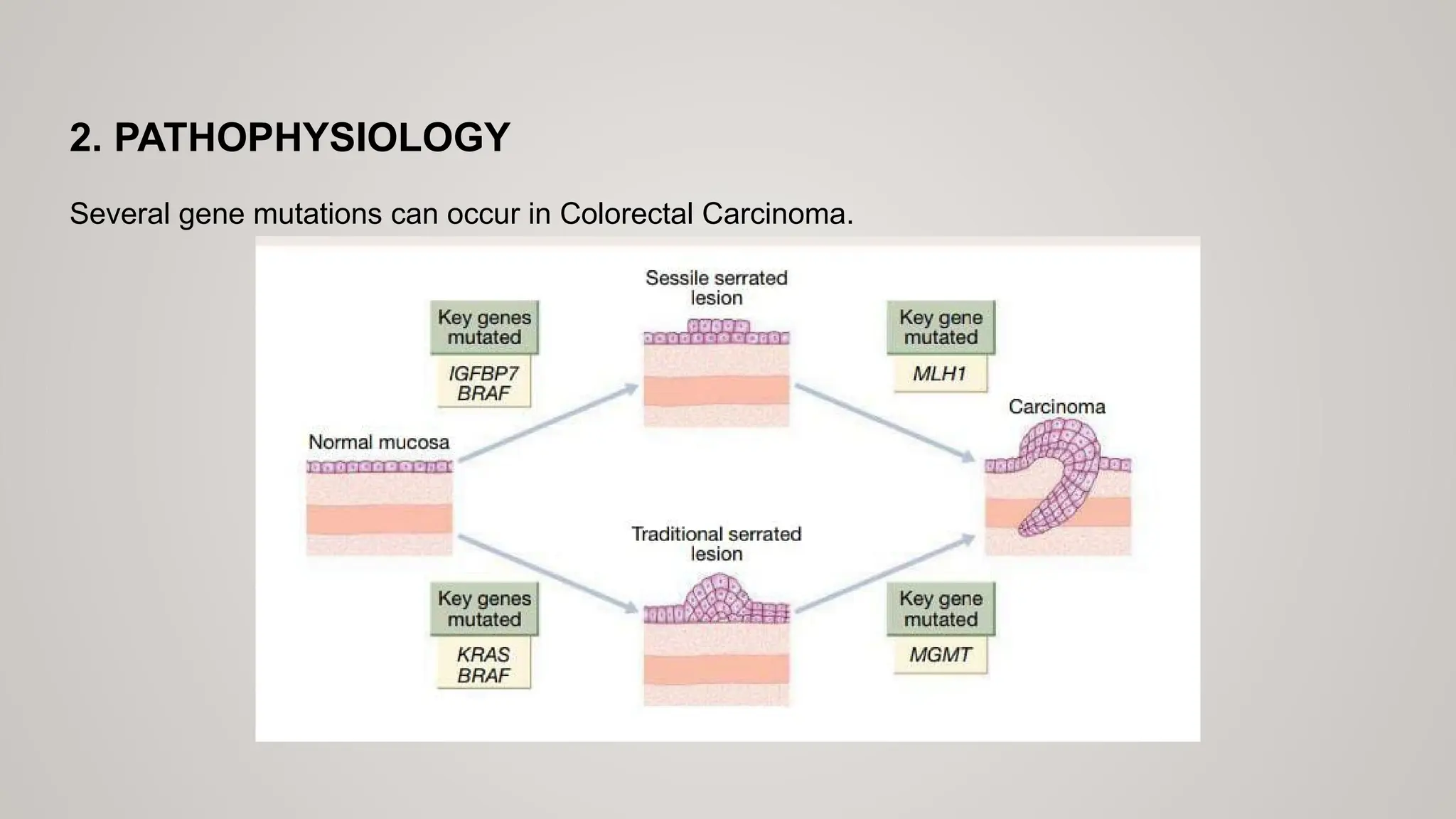 Colorectal Carcinoma presentation 1.pptx