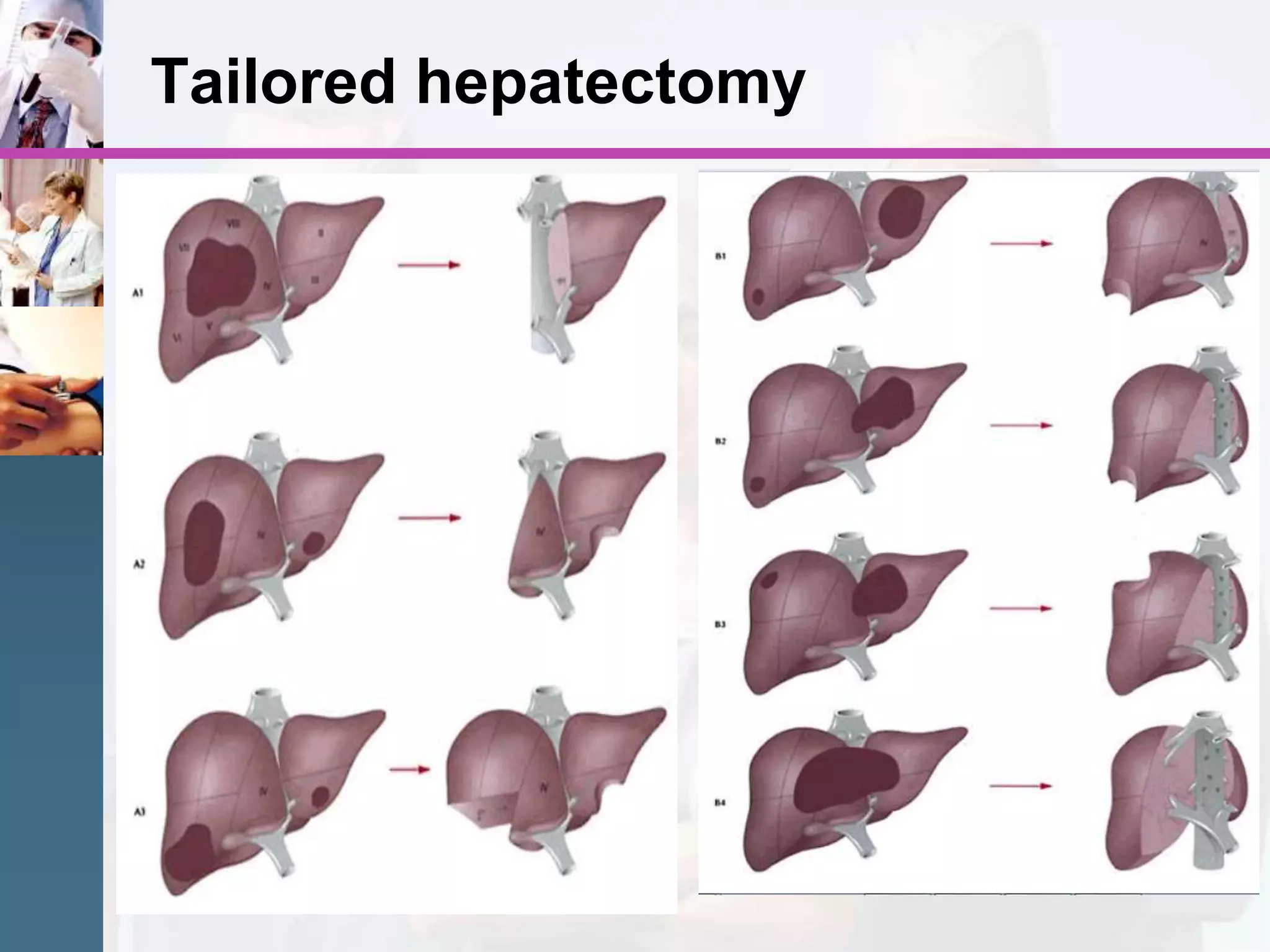 Colorectal Liver Metastases Multidisciplinary Approach 2 2 Ppt