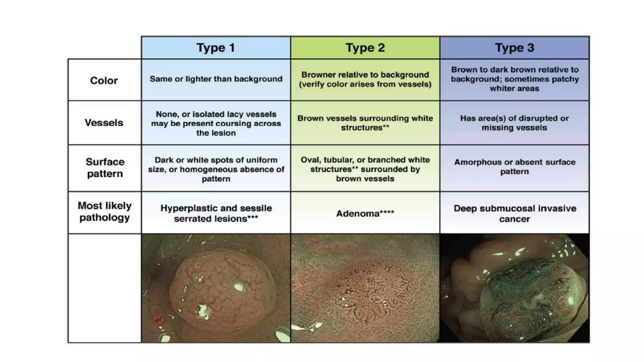Colorectal Polyp Pptx