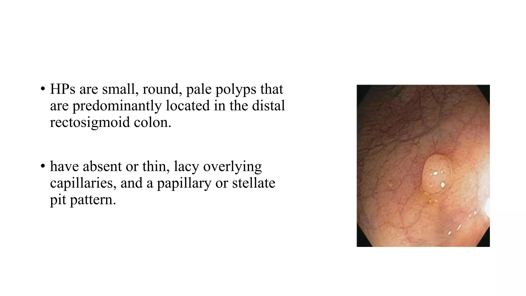 Colorectal Polyp.pptx | Digestive Disorders | Diseases and Conditions