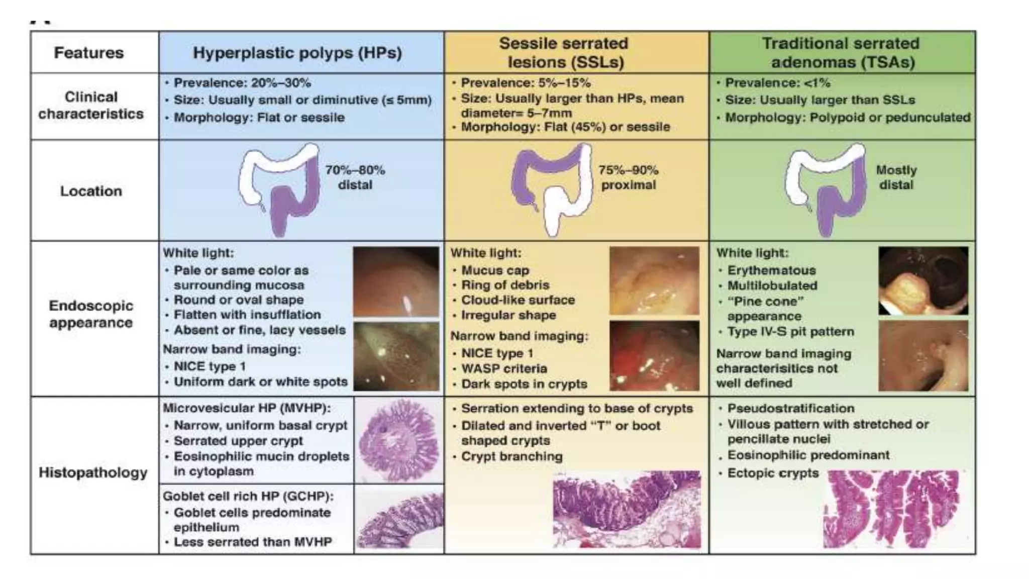 Colorectal Polyp Pptx Digestive Disorders Diseases And Conditions