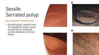 Colorectal polyps1.pptx