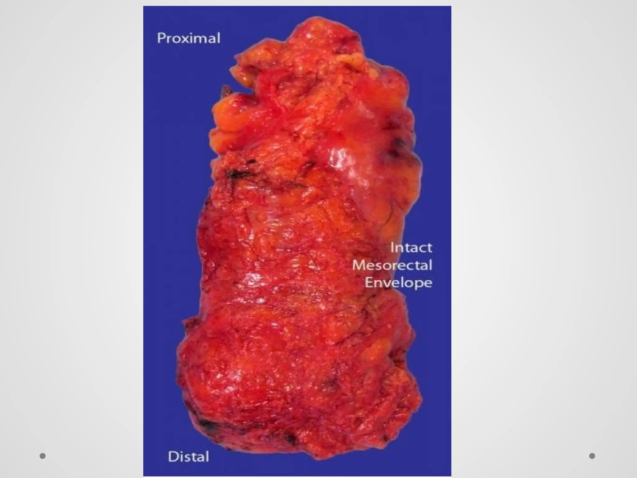 Grossing a colorectal specimen .pptx