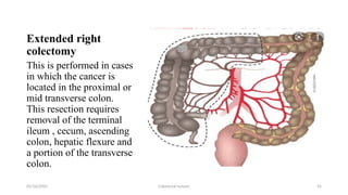 COLORECTAL TUMORS-1-2.pptx in surgeryppt | PPTX