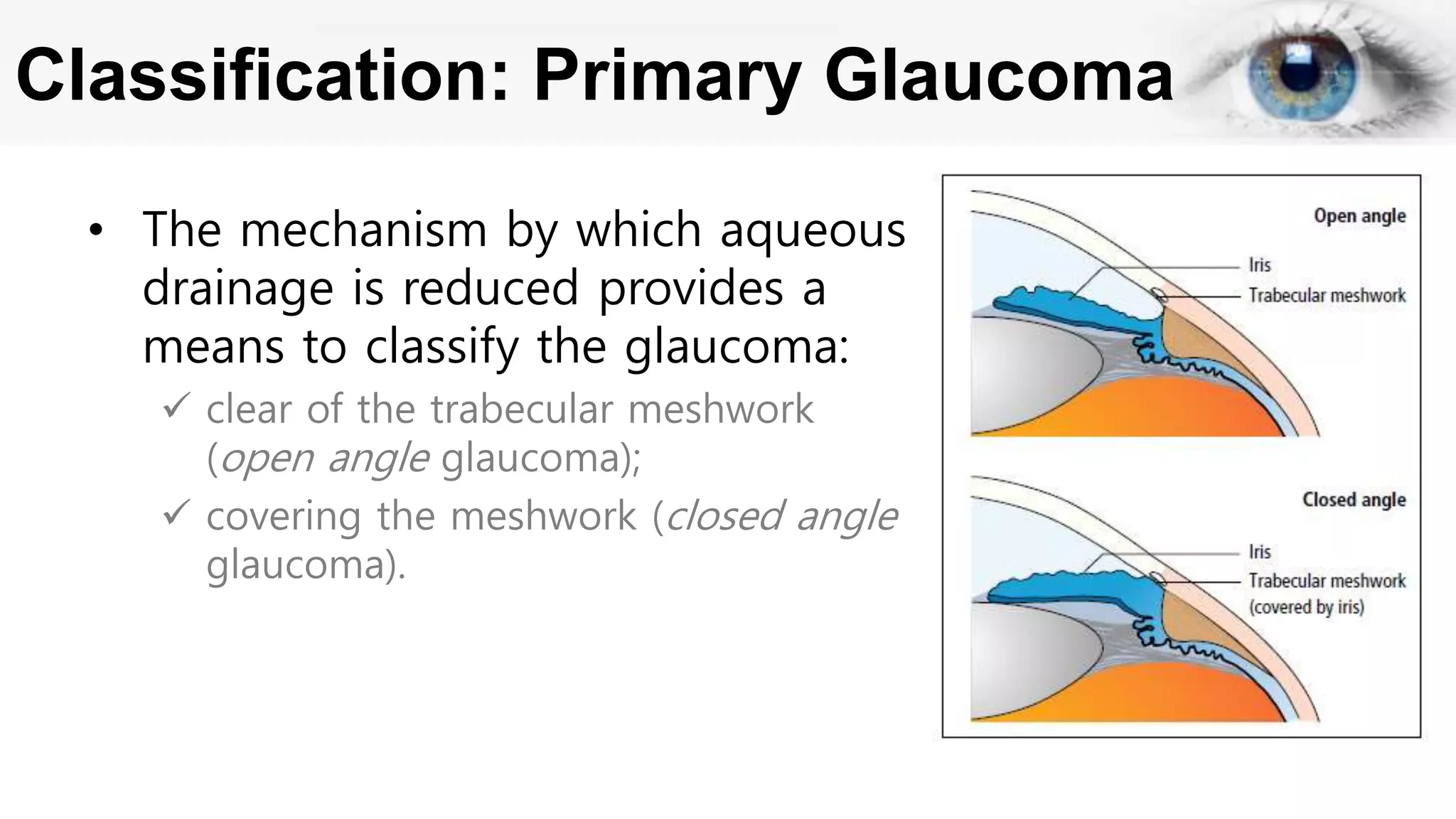 Glaucoma | PPTX