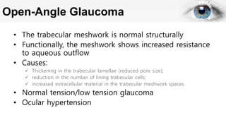 Glaucoma | PPTX
