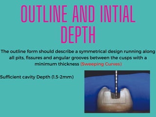 Conservative Dentistry: Class I Cavity preparation | PPTX