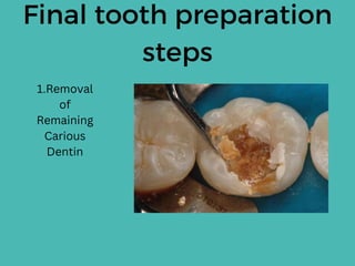 Conservative Dentistry: Class I Cavity preparation | PPTX