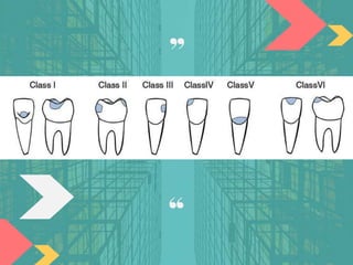 Conservative Dentistry: Class I Cavity preparation | PPTX