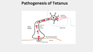 Fasciculation , Fibrillation , clonus and Tetanic contractions | PDF