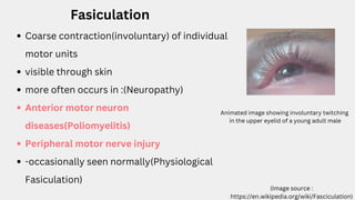 Fasciculation , Fibrillation , clonus and Tetanic contractions | PDF