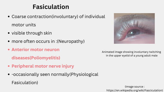 Fasciculation , Fibrillation , clonus and Tetanic contractions | PDF