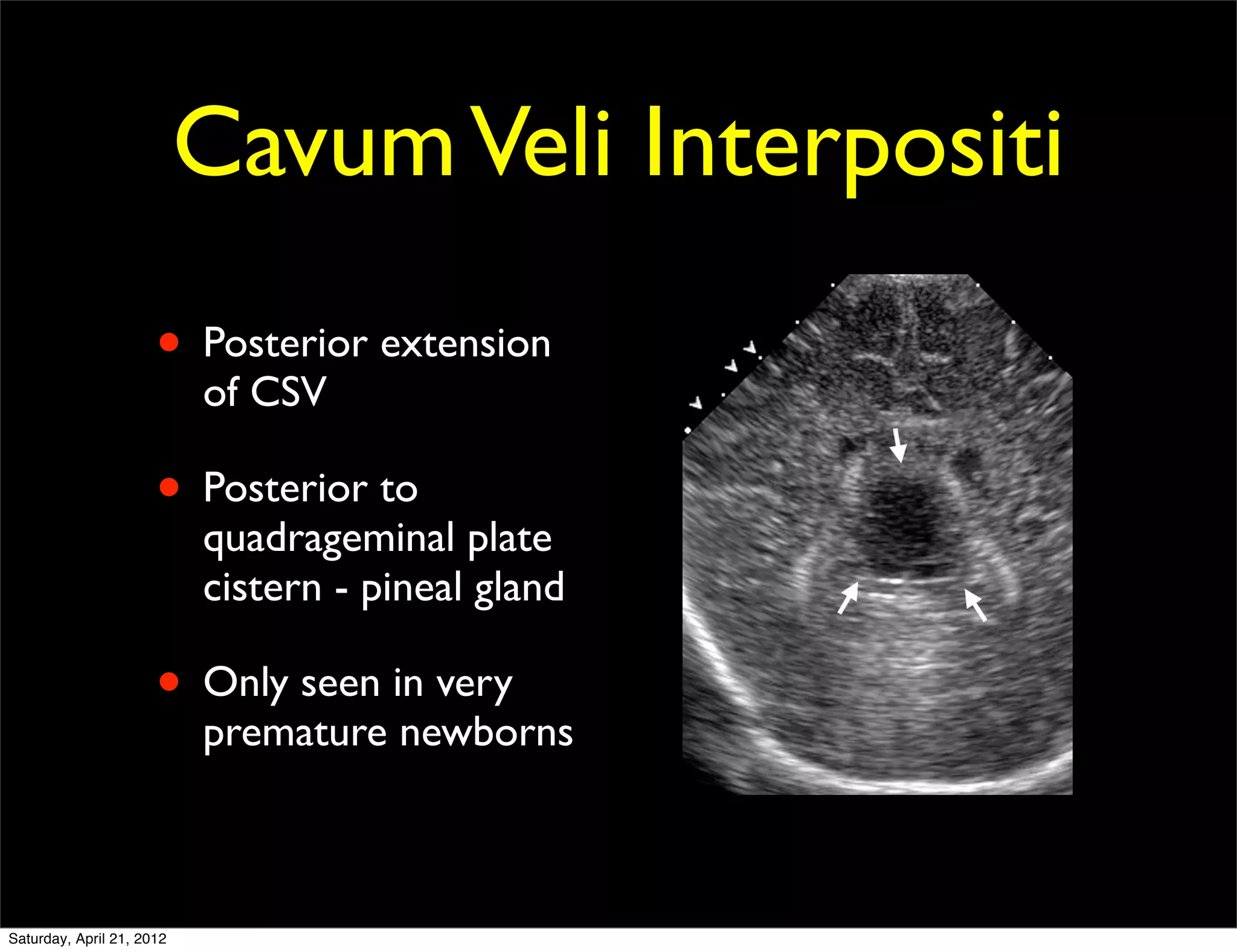 Neonatal Cranial Spinal Sonography | PDF