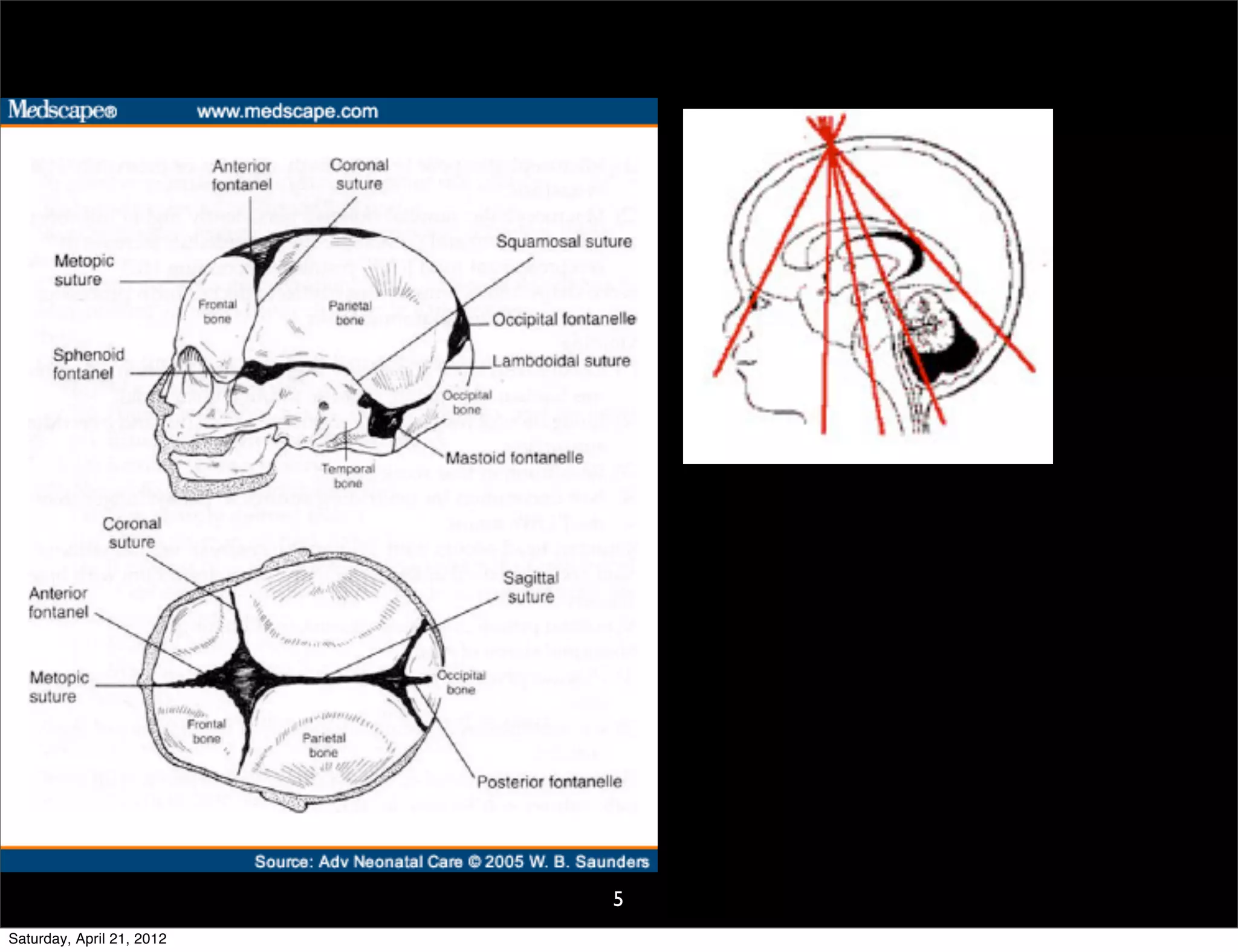 Neonatal Cranial Spinal Sonography | PDF