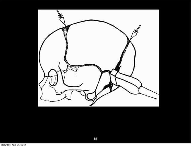 Neonatal Cranial Spinal Sonography | PDF