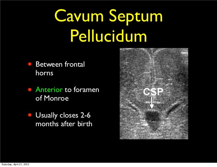 Cavum Vergae Ultrasound