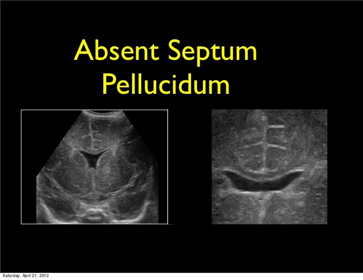 Neonatal Cranial Spinal Sonography