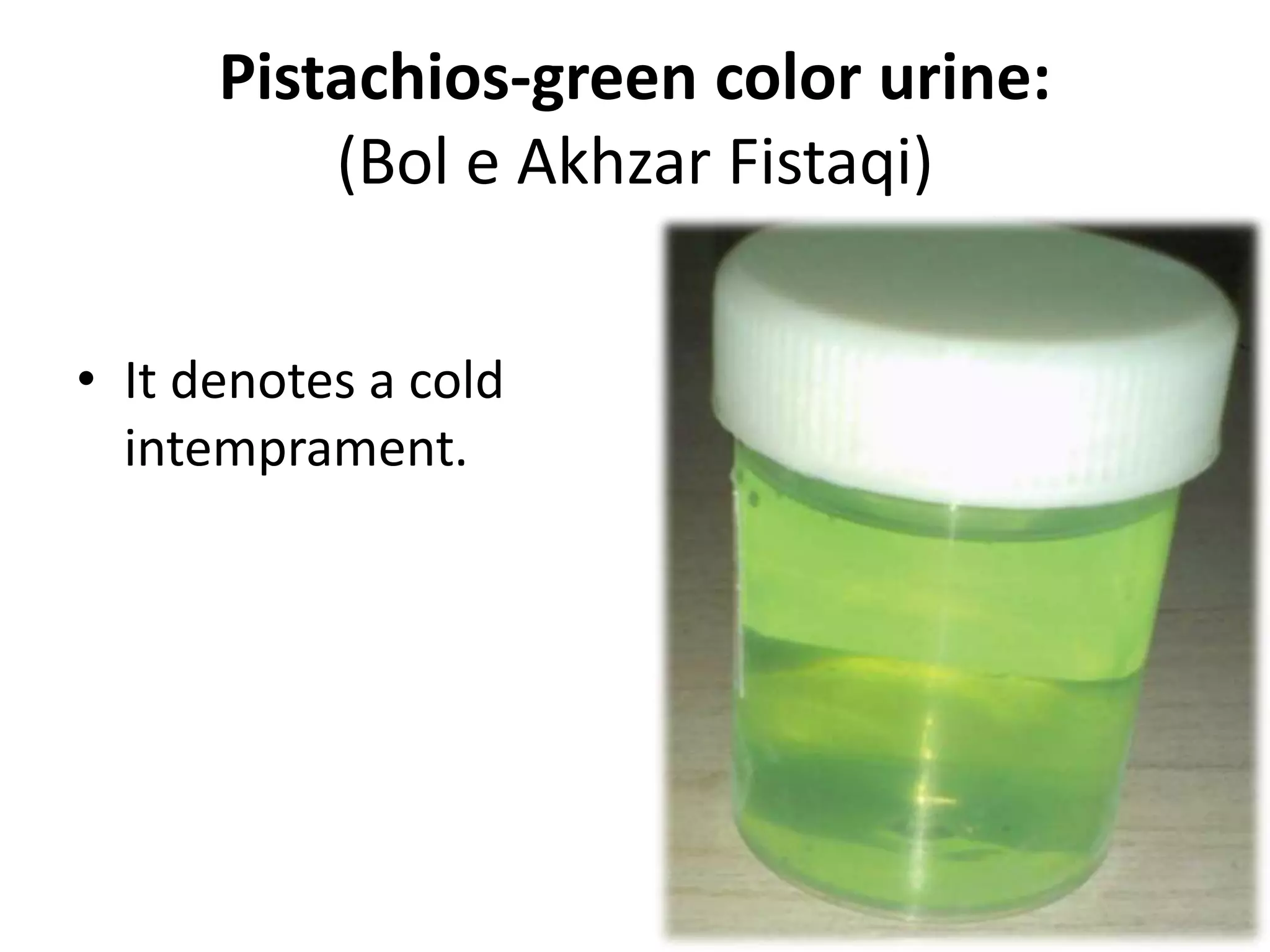 Colors of Urine (Qaroorah) and diagnosis through it. (The Unani Tibbi ...