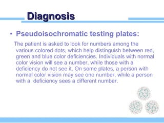 Color vision | PPT