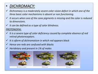 Color vision and its anomalies | PPTX