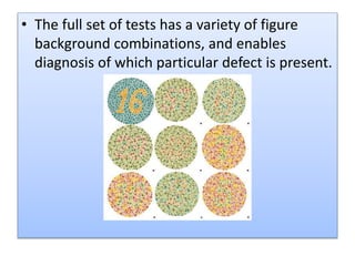 Color vision and its anomalies | PPTX