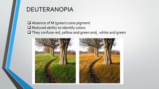 Color vision - concepts | PPTX