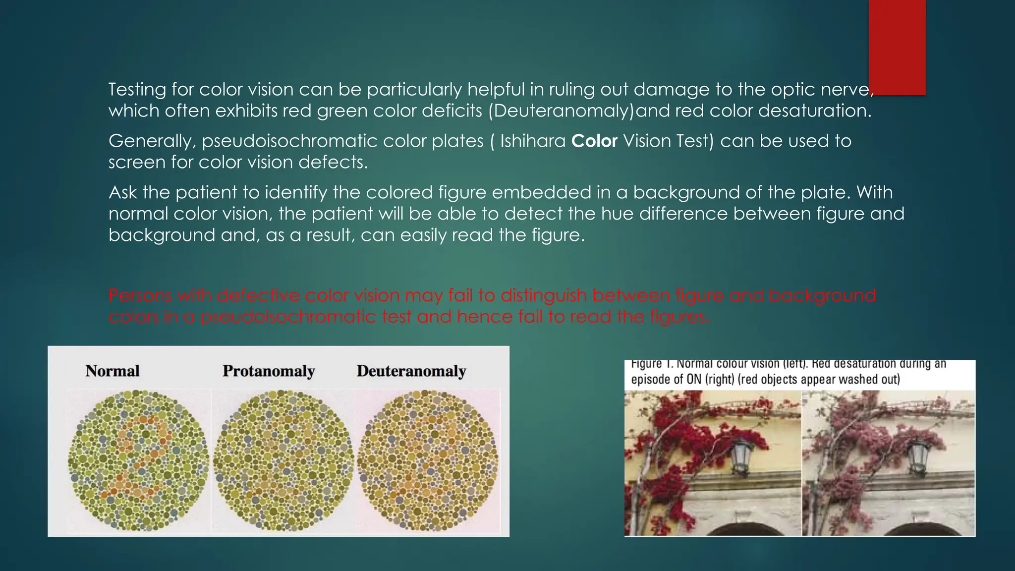 Color Vision..pptx mesicine surgey clinical | PPT