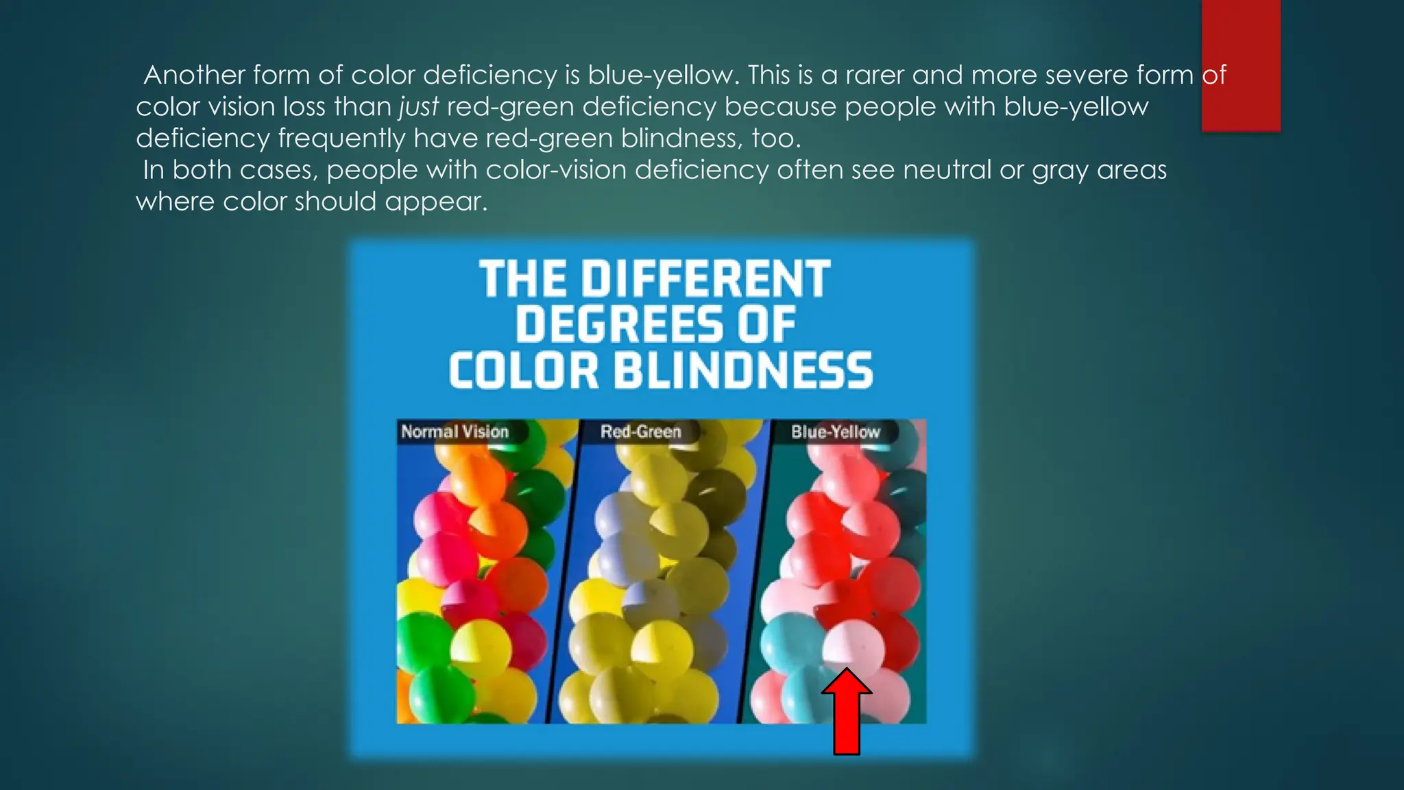 Color Vision..pptx mesicine surgey clinical | PPTX