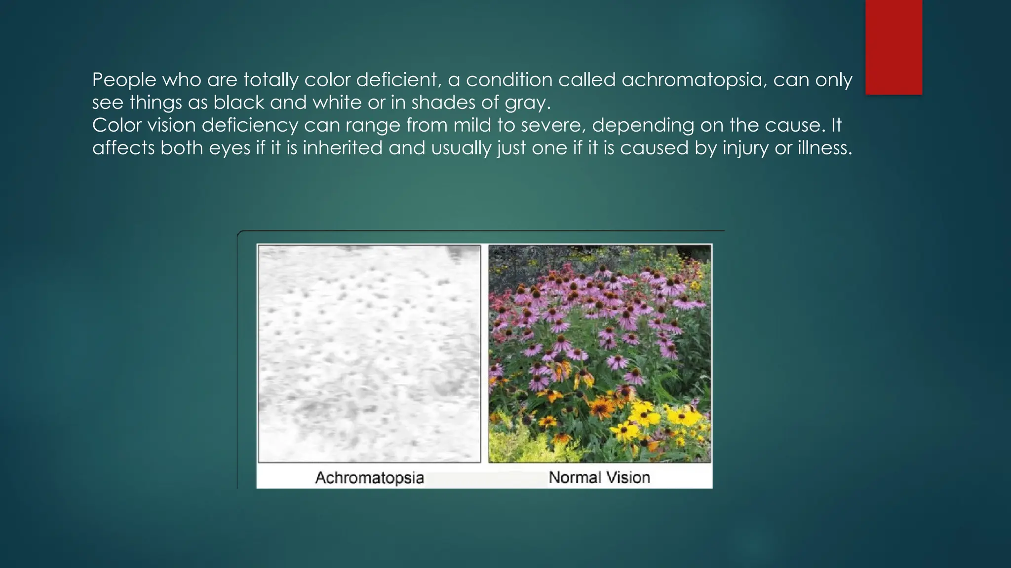 Color Vision..pptx mesicine surgey clinical | PPTX