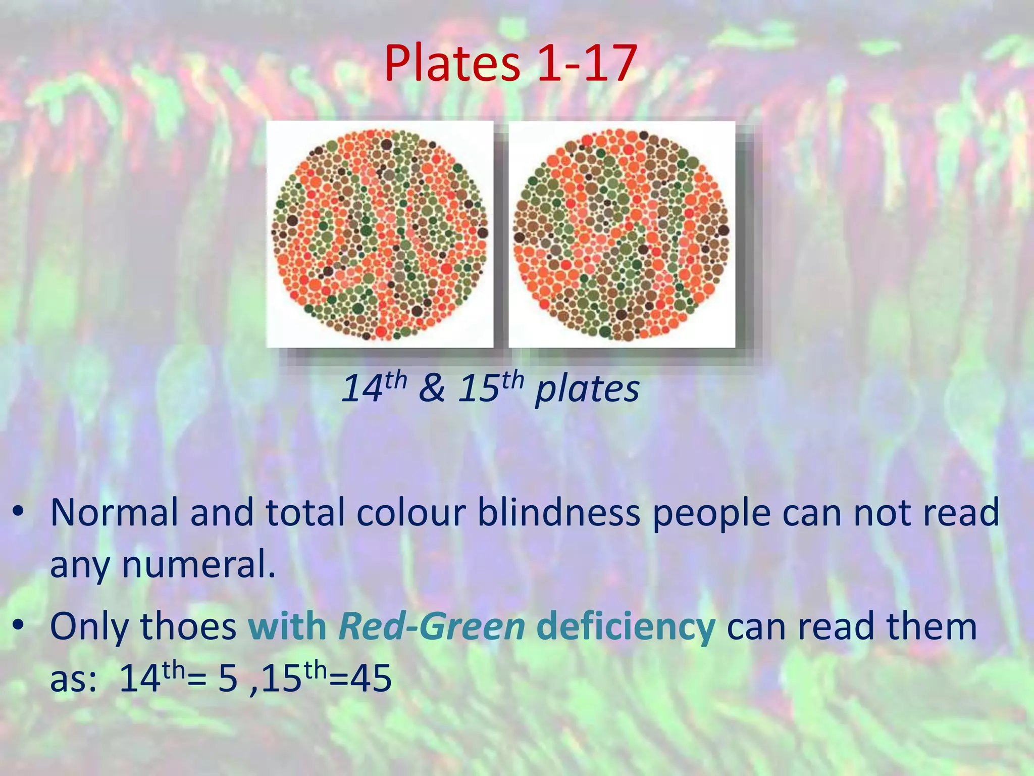 Color vision deficiency and ishiharas test | PDF