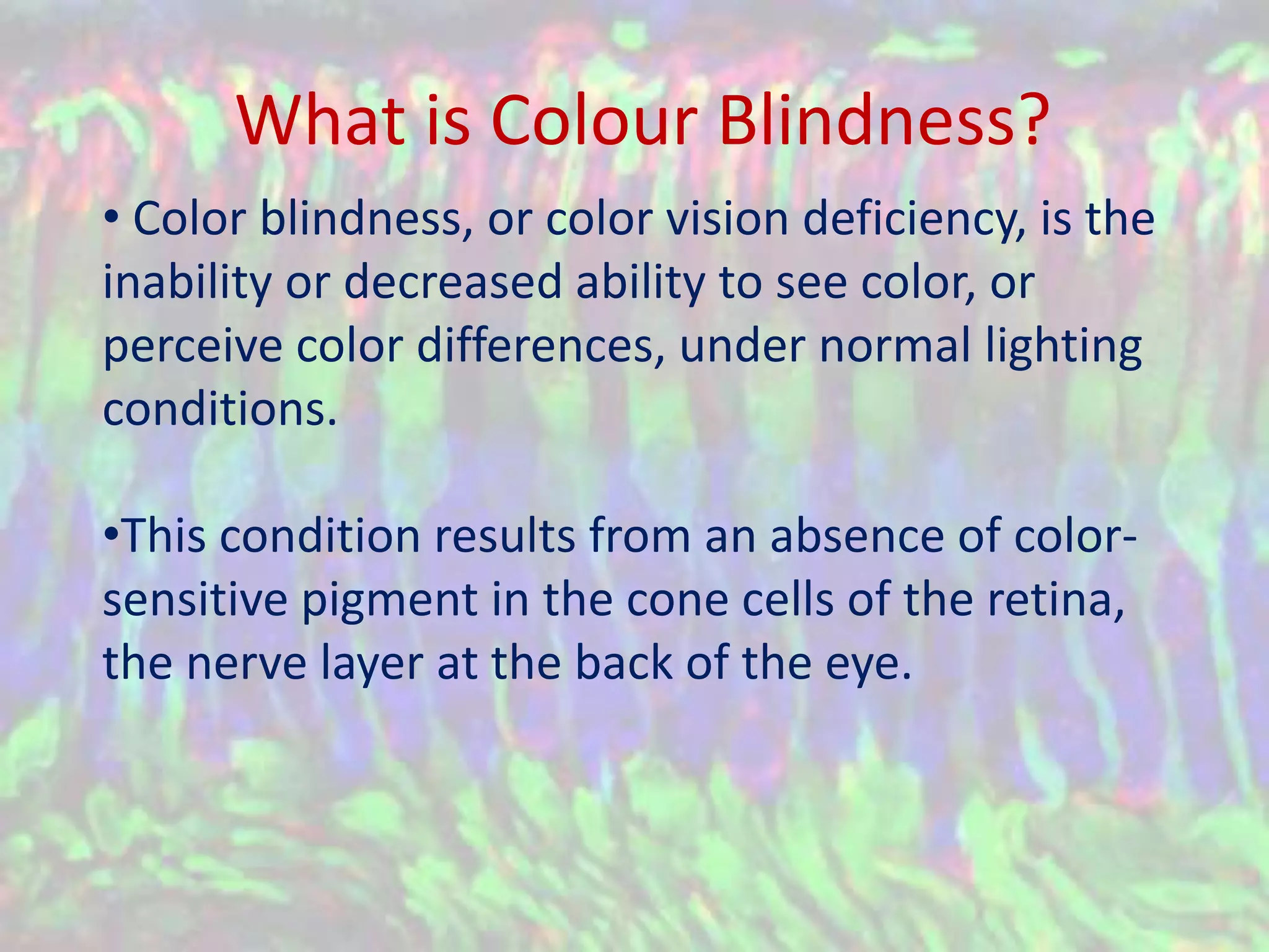 Color vision deficiency and ishiharas test | PDF