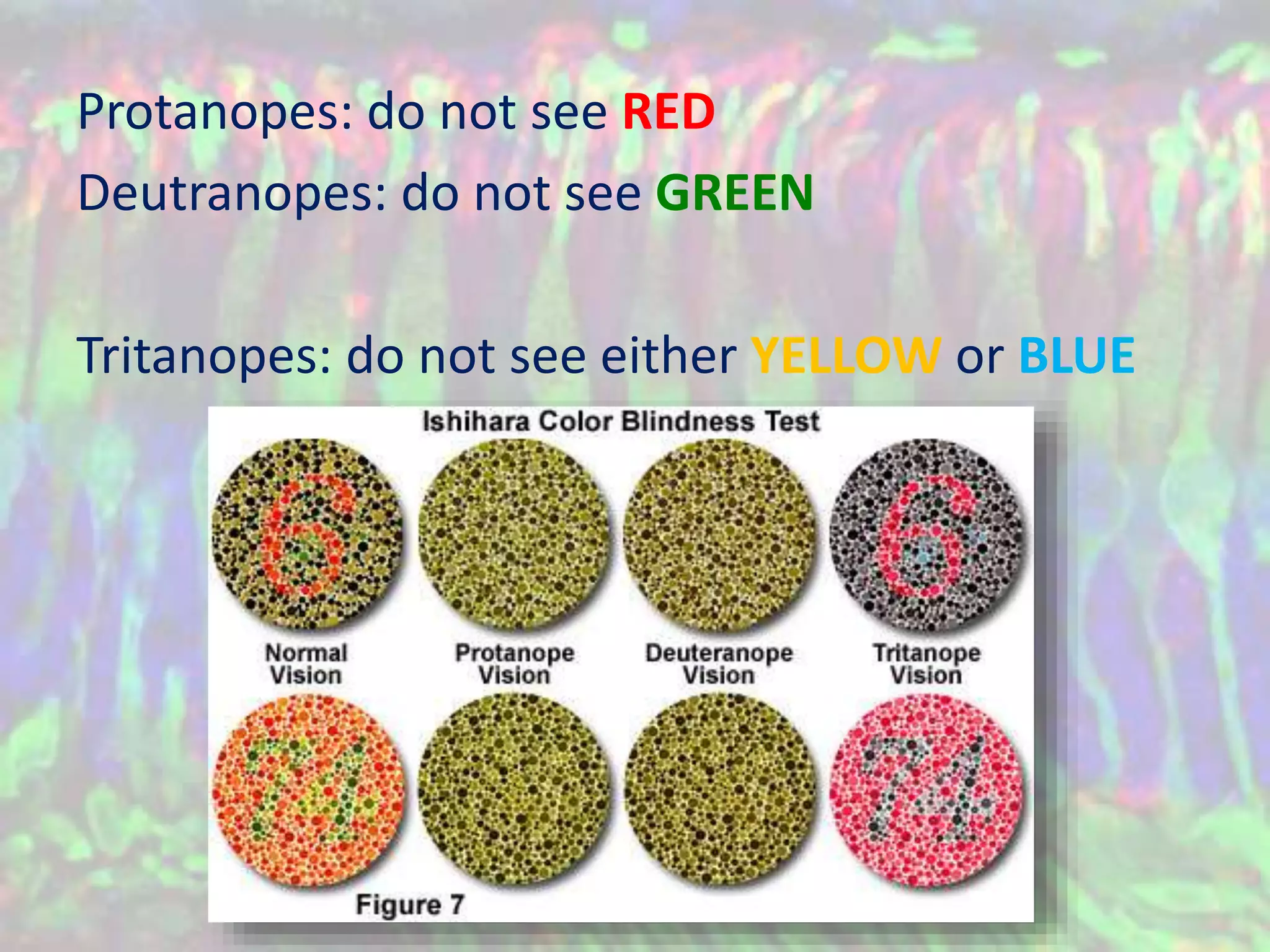 Color vision deficiency and ishiharas test | PDF