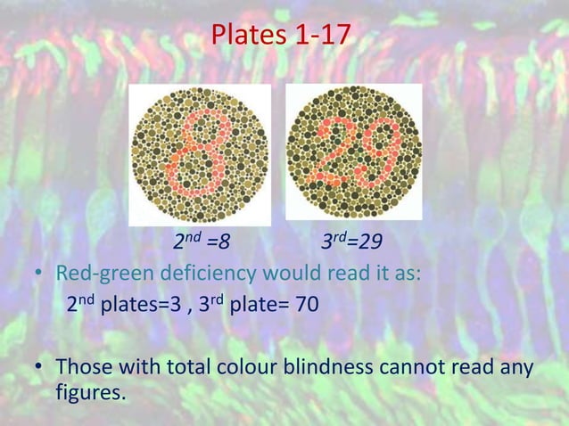 Color vision deficiency and ishiharas test | PDF | Eye and Vision ...