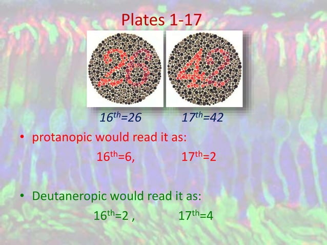 Color vision deficiency and ishiharas test | PDF | Eye and Vision ...