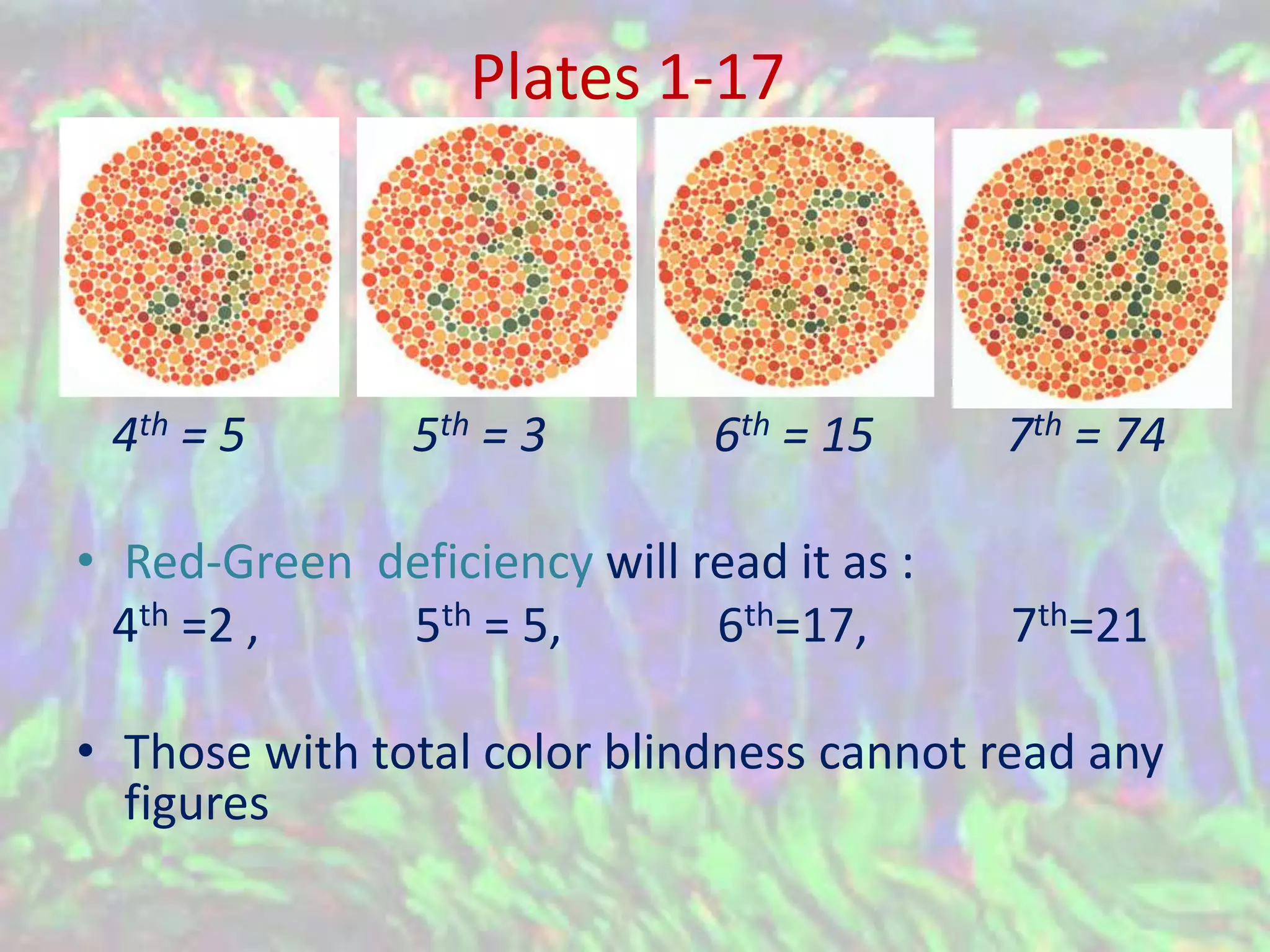 Color Vision Deficiency and Ishihara's Test | PPSX