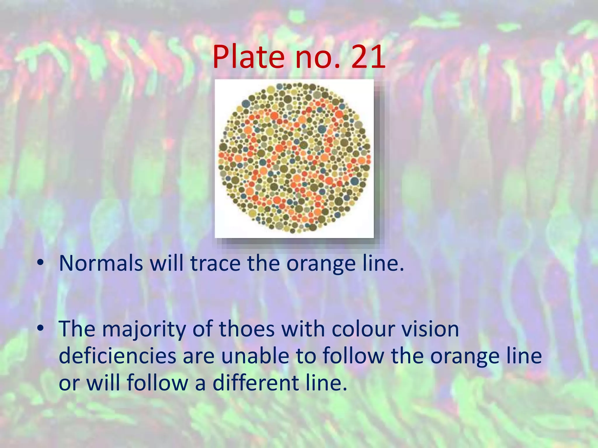 Color Vision Deficiency and Ishihara's Test | PPSX