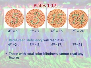 Color Vision Deficiency and Ishihara's Test | PPSX