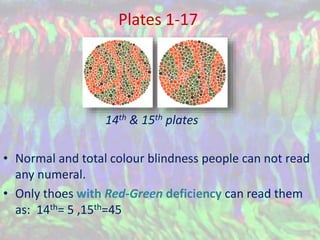 Color Vision Deficiency and Ishihara's Test | PPSX