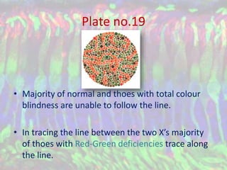 Color Vision Deficiency and Ishihara's Test | PPSX