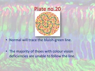 Color Vision Deficiency and Ishihara's Test | PPSX